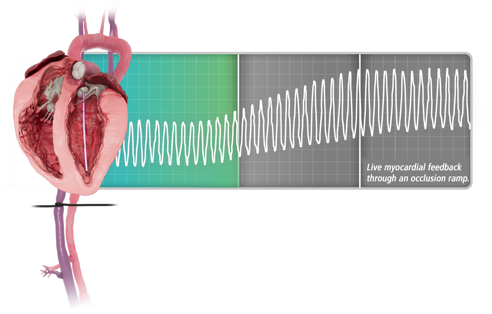 ADV550 Pressure-Volume Loops | Transonic