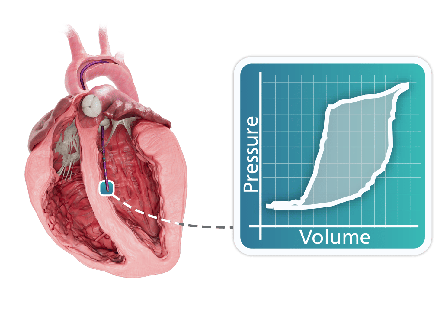 ADV550 Pressure-Volume Loops | Transonic
