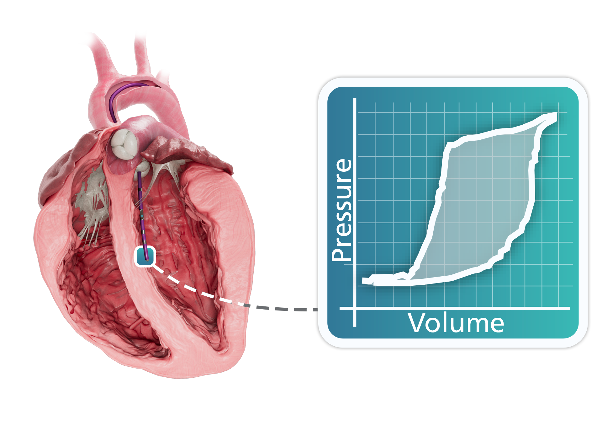 ADV550 Pressure-Volume Loops | Transonic