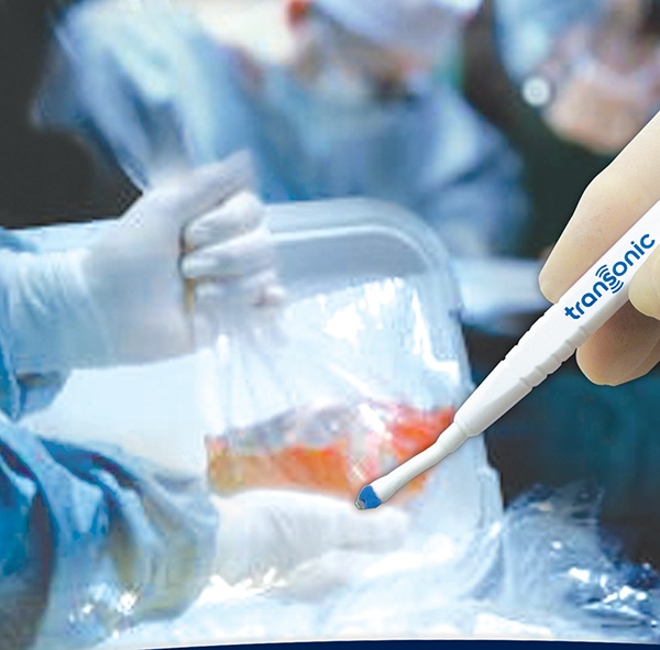 Flow-Assisted Surgical Technique during Transplant Surgery