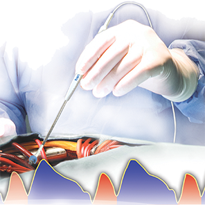 Flow-Assisted Surgical Technique in Cardiac Surgery